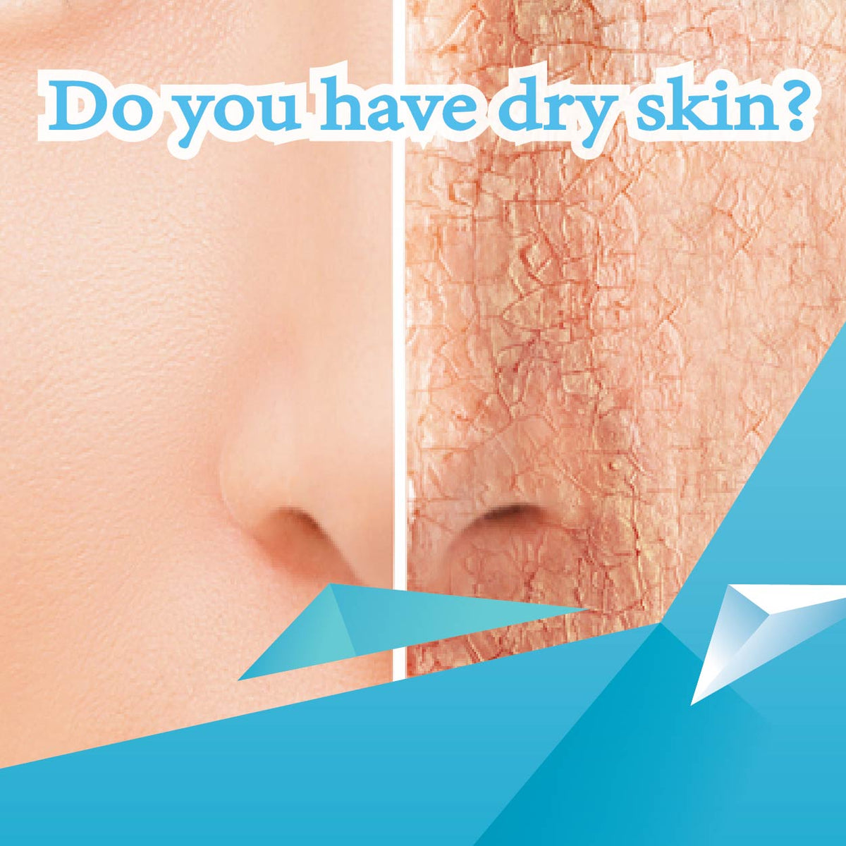 Do You Have Dry Skin Biosense Clinic