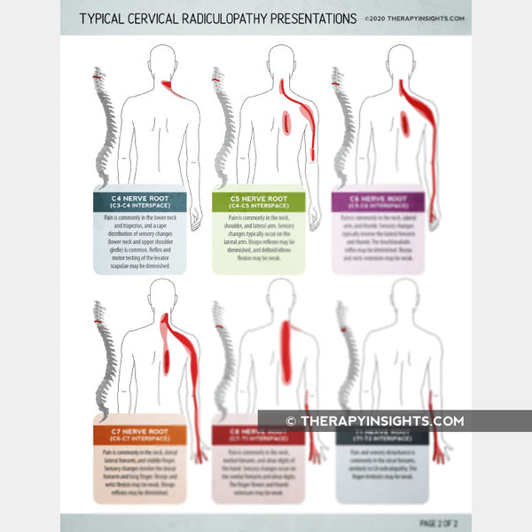 Typical Cervical Radiculopathy Presentations Therapy Insights