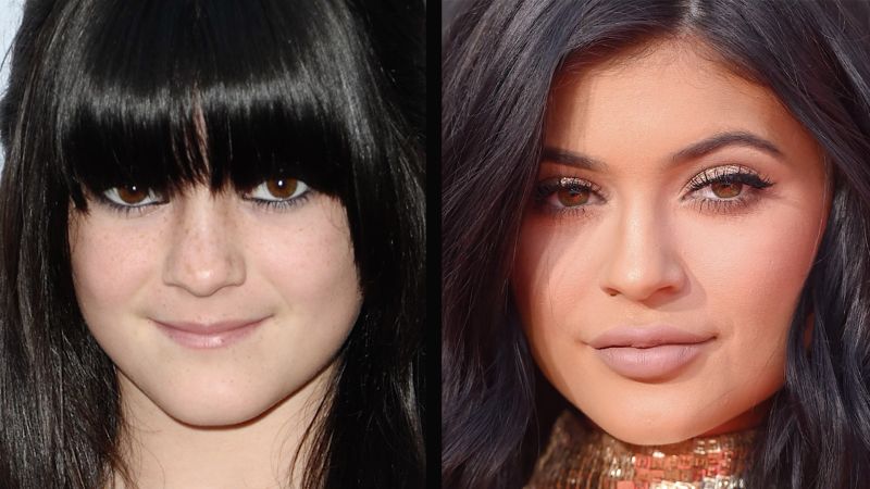 Watch Kylie Jenners Amazing Transformation Teen Vogue Video Cne