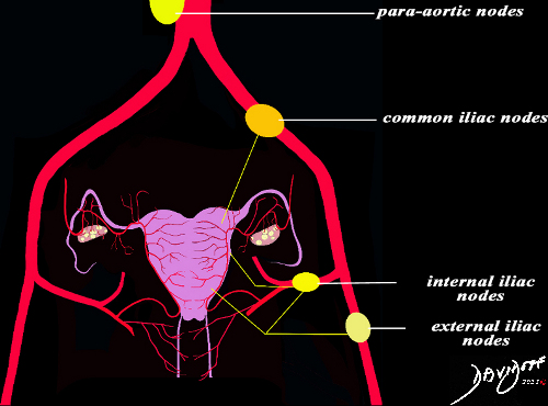 Lymphatic Drainage And Lymph Nodes Of The Uterus And Ovaries Art In