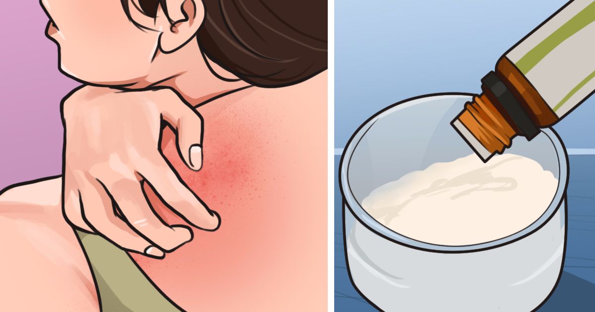 Put A Stop To Itchy Skin With These 7 Home Remedies — Info You Should Know