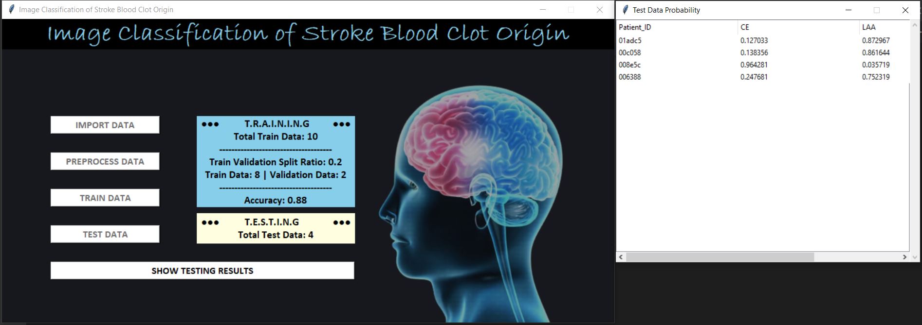 Github Priyansh42stroke Blood Clot Classification This Model