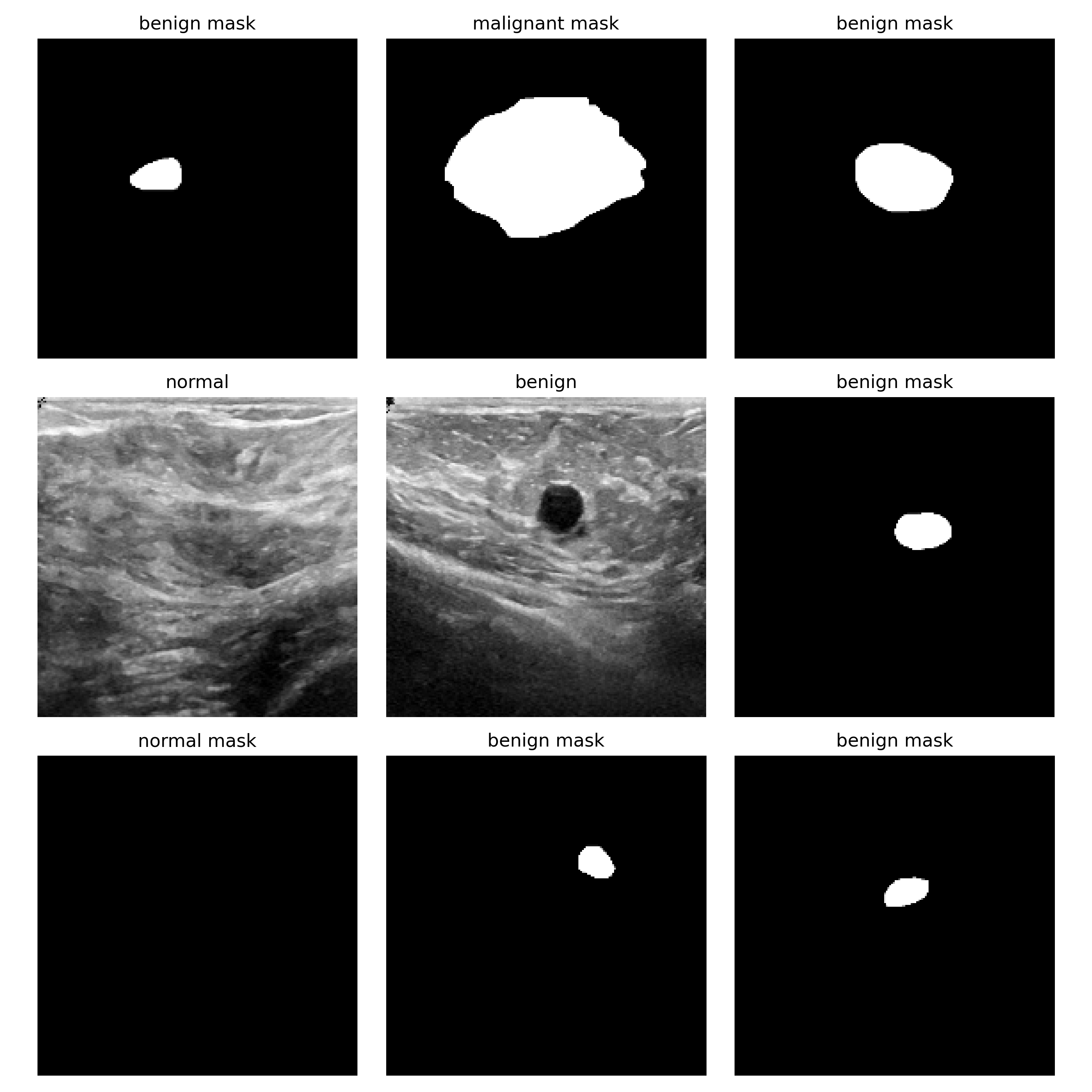 Github Kerriea Starbreast Cancer Detection A Deep Learning Project