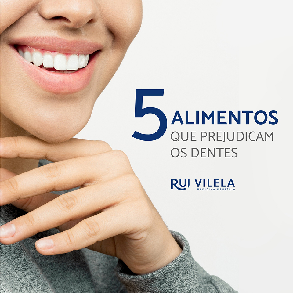 5 Alimentos Que Prejudicam Os Dentes Atra