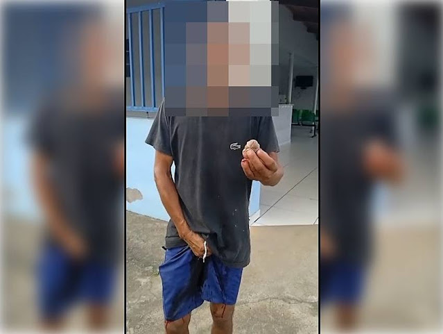 Homem Corta O Próprio Pênis Afirmando Ter Feito Aposta Com Um “tal Do