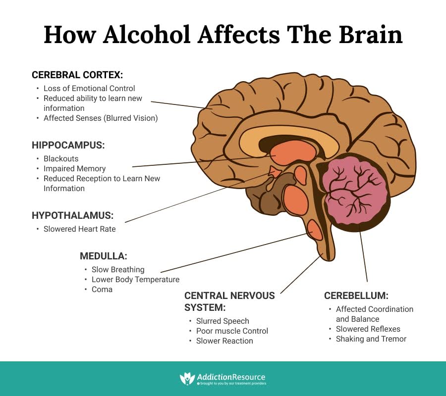 Alcohol And Brain Infographic Visualistan