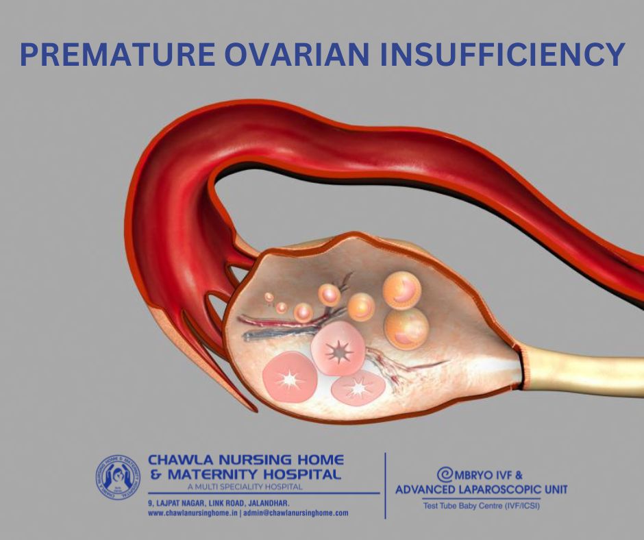 Premature Ovarian Insufficiency Diagnosis And Treatment Options