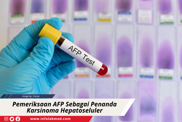 Pemeriksaan Afp Sebagai Penanda Karsinoma Hepatoseluler Manfaat Dan