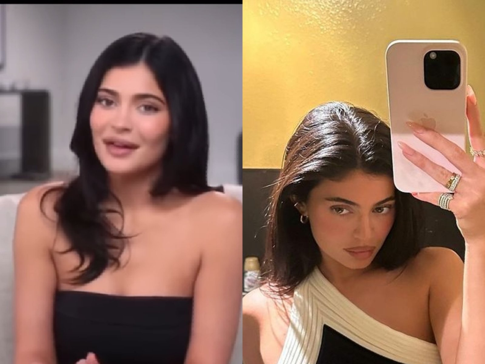 Kylie Jenner Reveals That She Has Done Only Chest Surgery All