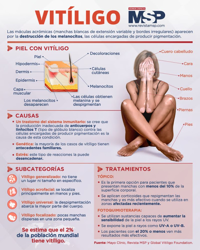 Mitos Y Verdades Del Vitiligo Infografia By Msp Med Tac