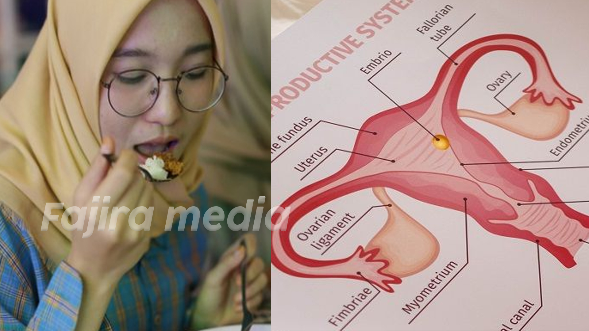 Awas Hati Hati Jangan Di Konsumsi Kista Bersarang Di Rahim Wanita