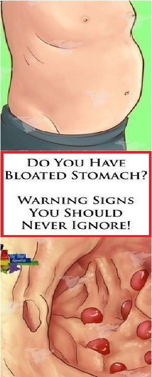 Do You Have Bloated Stomach Warning Signs You Should Never Ignore