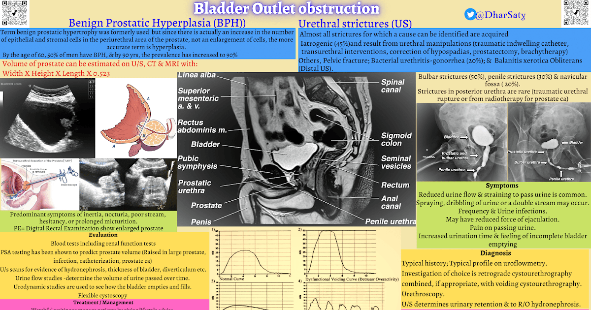 Bladder Outlet Obstruction Boo Medical Infographics