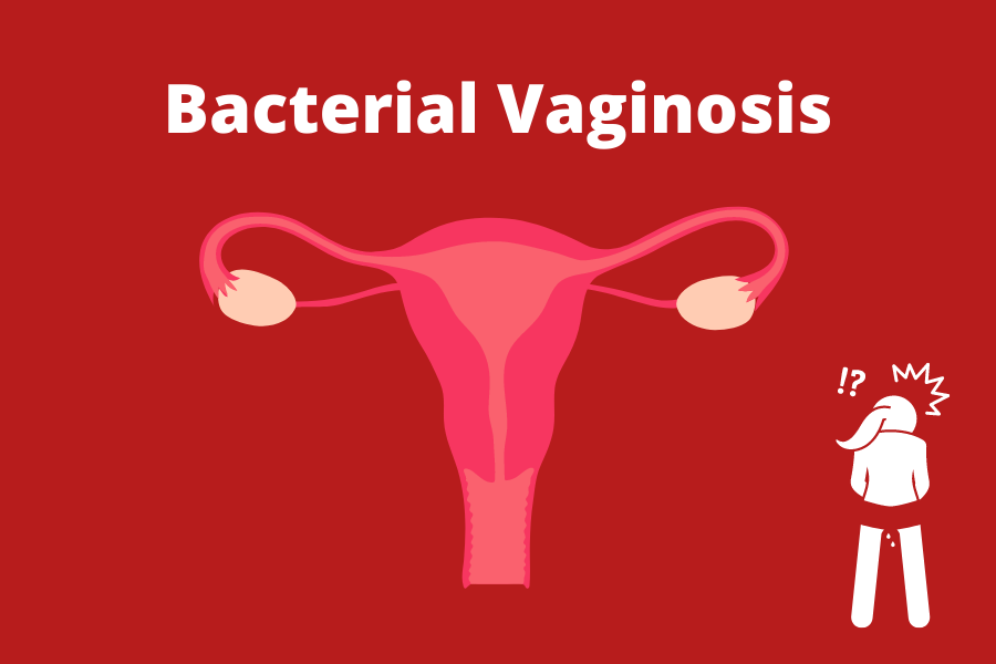 What Is Bacterial Vaginosis Symptoms Causes Diagnosis And More