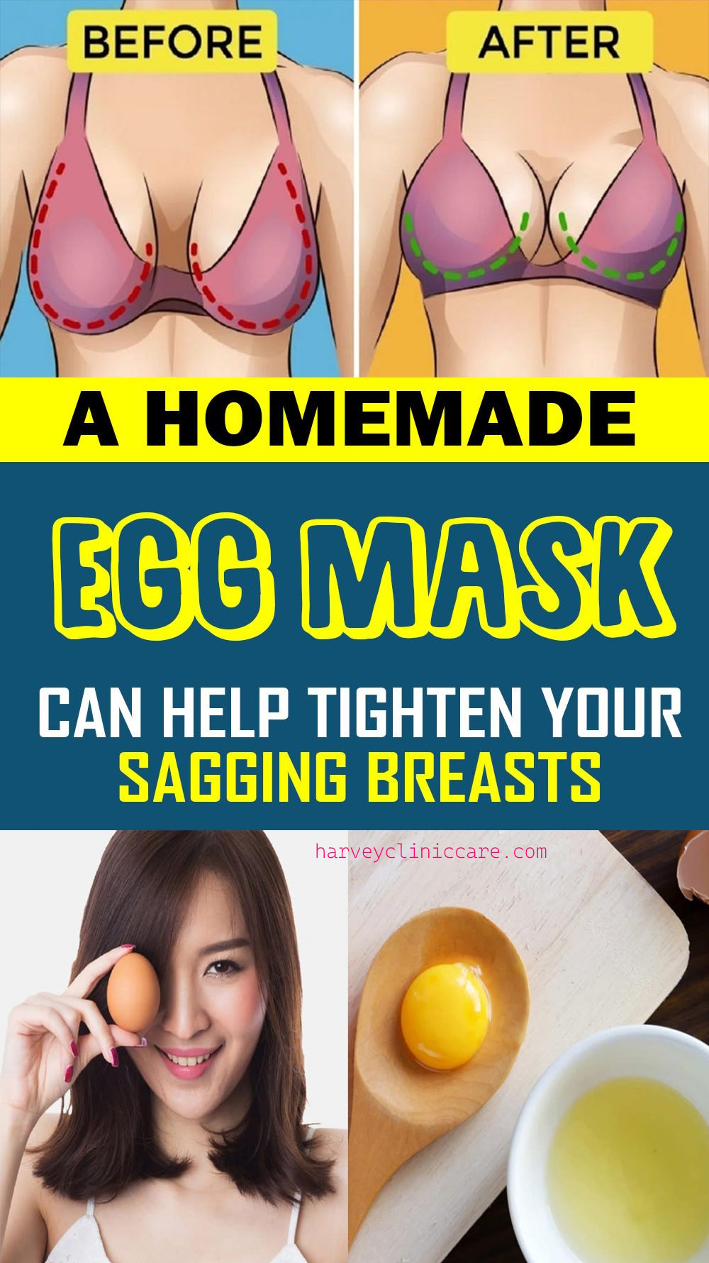 A Homemade Egg Mask Can Help Tighten Your Sagging Breasts Healthy