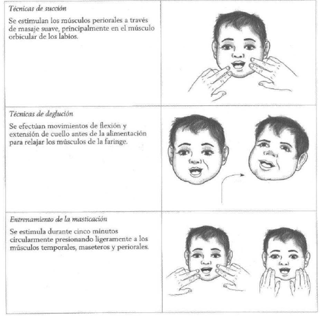 Técnicas De Rehabilitación Neurológica Método Rood