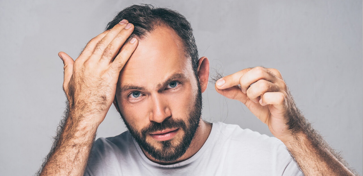 Blog Jornal Da Mulher A Testosterona Influência Na Queda De Cabelo