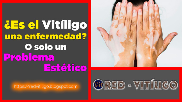 Red Vitiligo