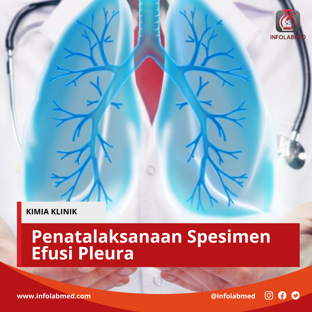 Efusi Pleura Patofisiologi Diagnosis Penatalaksanaan Alomedika The