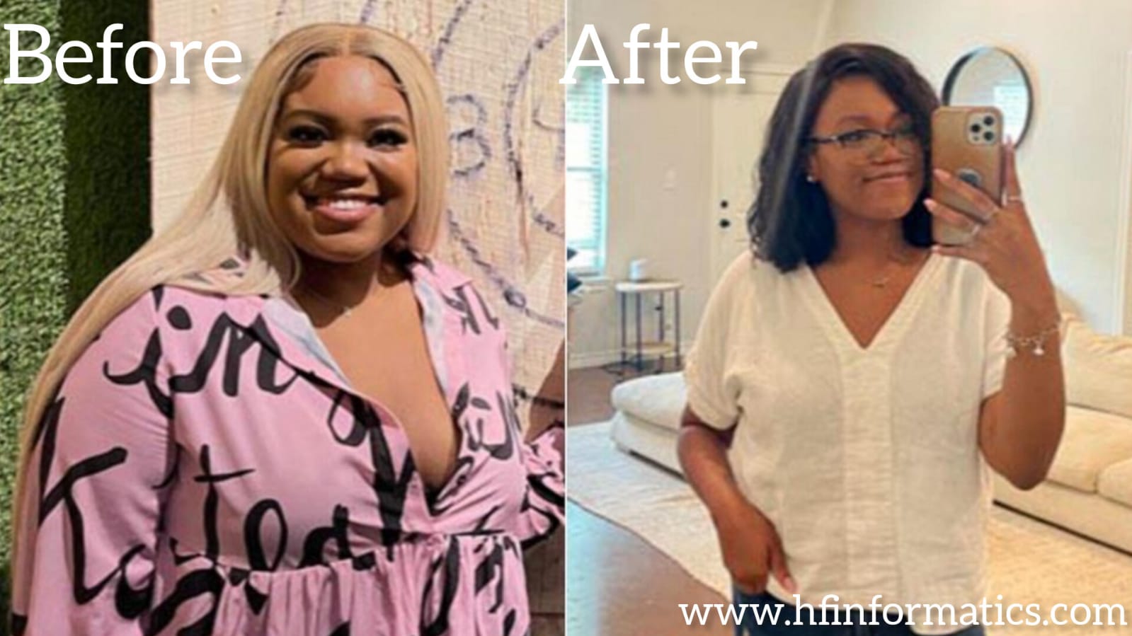 Mounjaro Weight Loss Before And After