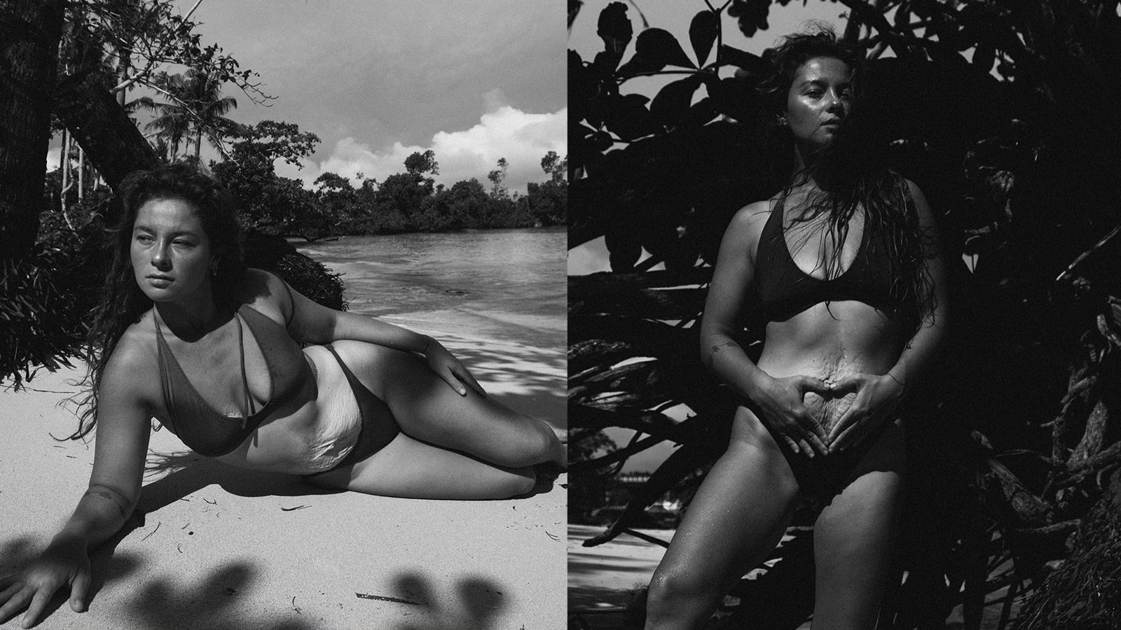 Andi Eigenmann Flaunts Her Stretch Marks In A Gorgeous Unedited