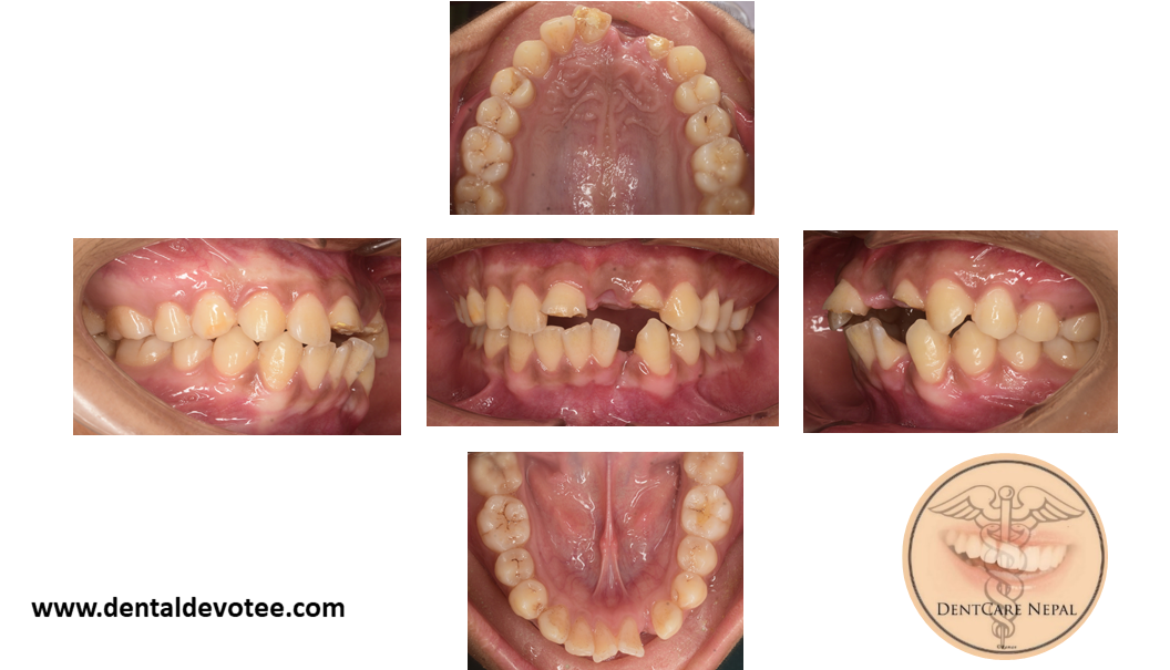 Dentosphere World Of Dentistry Intraoral Photography In Orthodontics