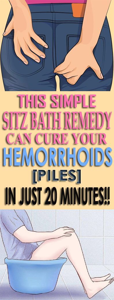 This Simple Remedy Can Cure Your Hemorrhoids In Just 20 Minutes