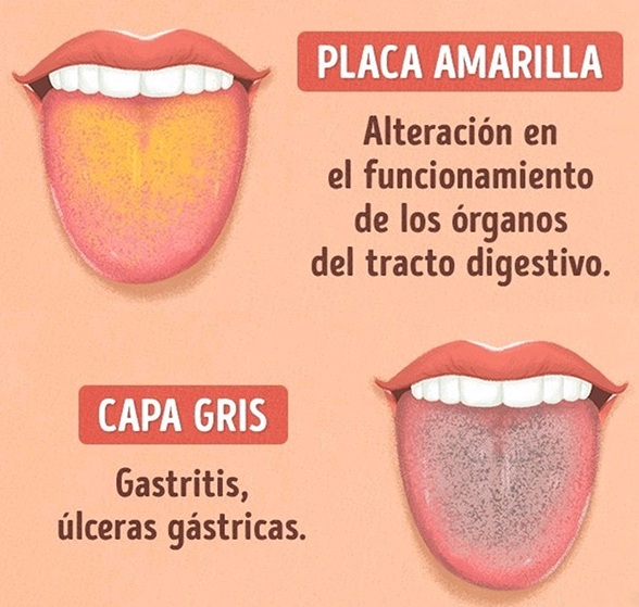 El Color De Tu Lengua Revela Tu Estado De Salud En Total Son 12