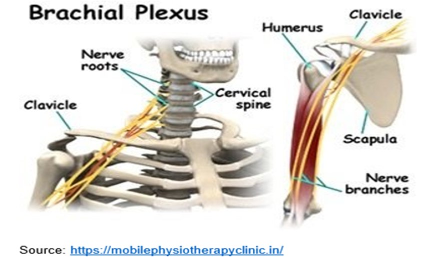 Brachial Plexus Injury Diagnosis And Treatment