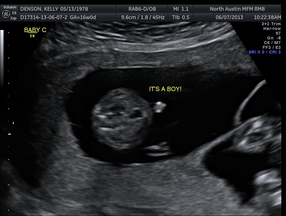 The Texas Trio A Triplet Pregnancy Blog 16 Week Ultrasound Pics