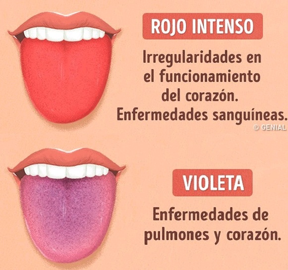 El Color De Tu Lengua Revela Tu Estado De Salud En Total Son 12