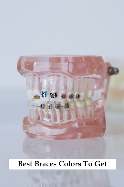 9 Best Braces Colors To Get Nsalif