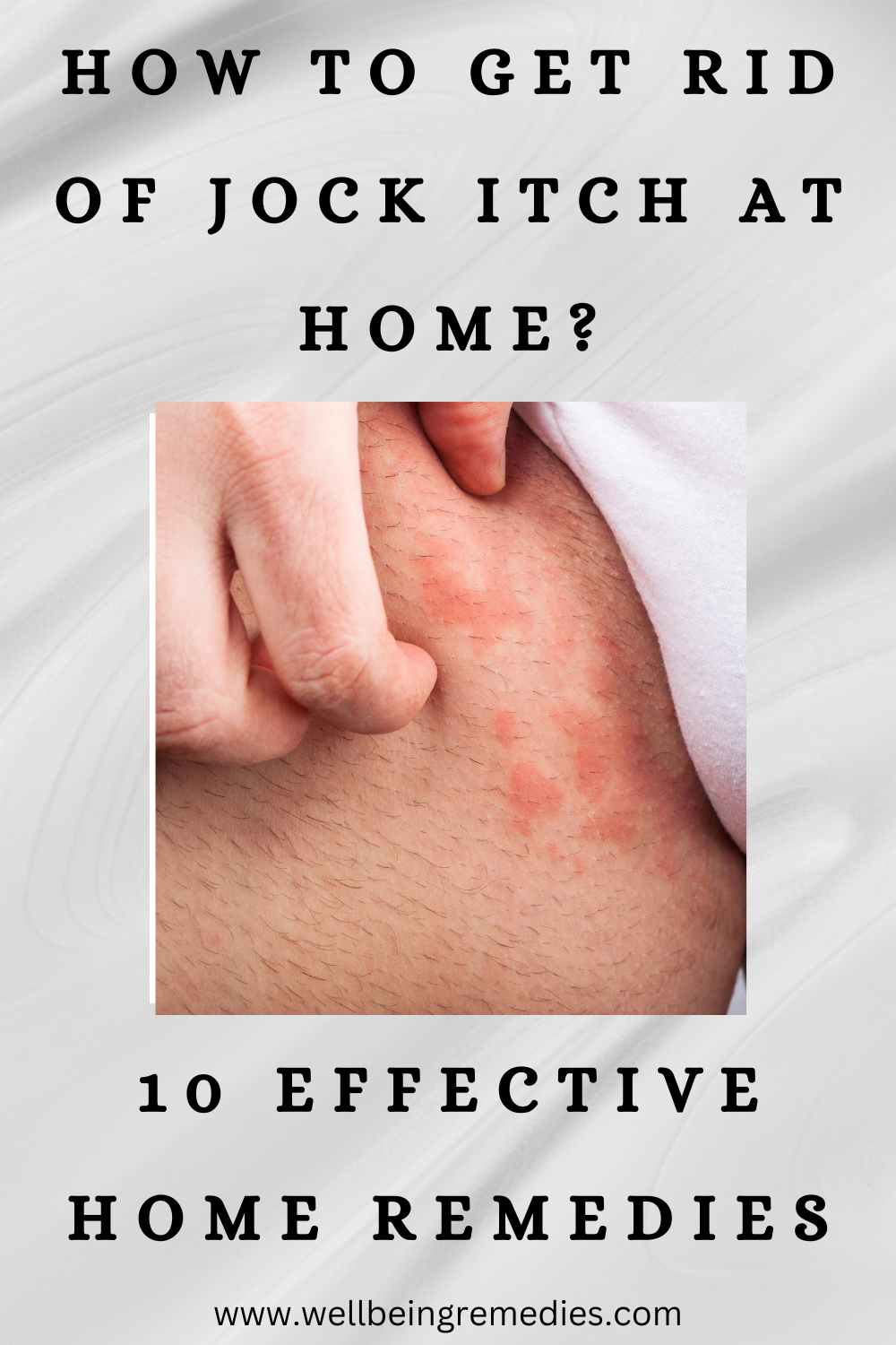 How To Get Rid Of Jock Itch At Home 10 Effective Home Remedies