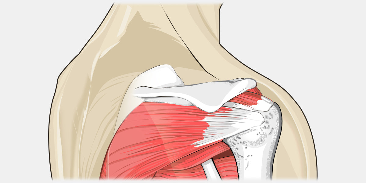 Shoulder Impingement Syndrome Swimmers Shoulder Explained Images And