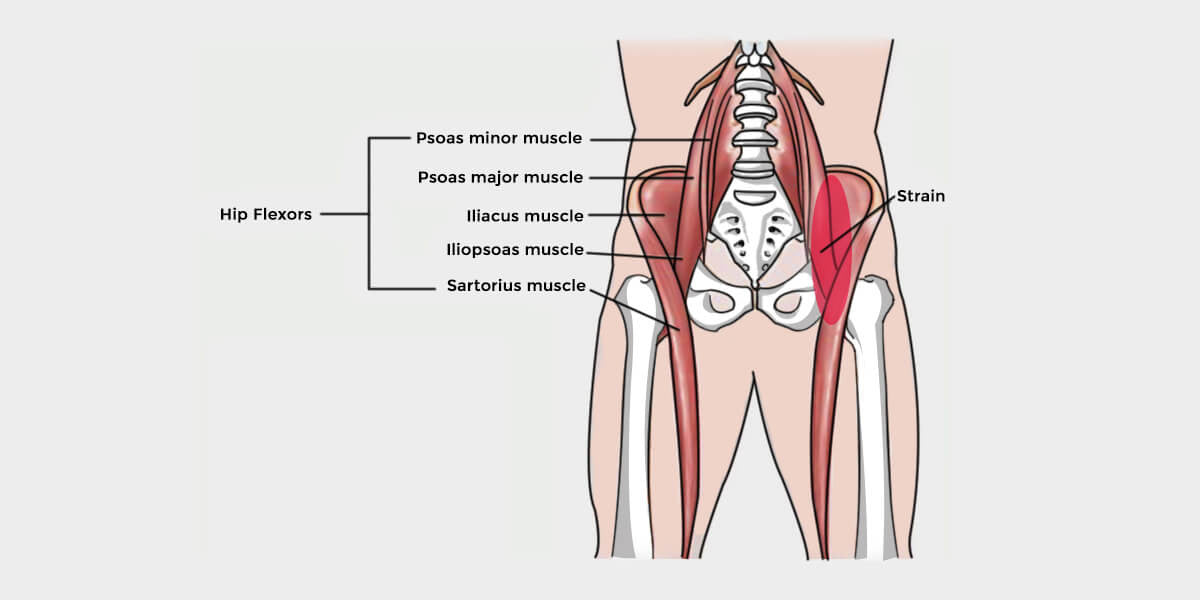 Hip Flexor Strain The Complete Injury Guide Vive Health