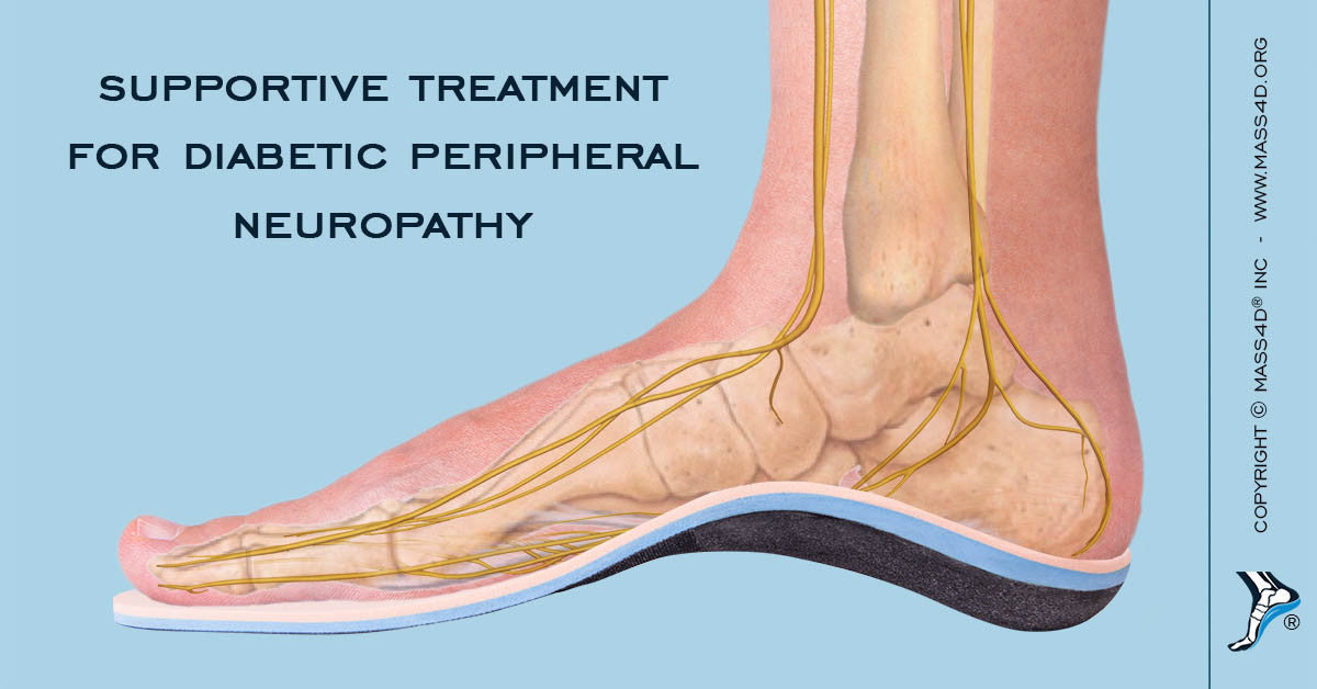 Diabetic Peripheral Neuropathy Treatment With Orthotics Mass4d® Foot