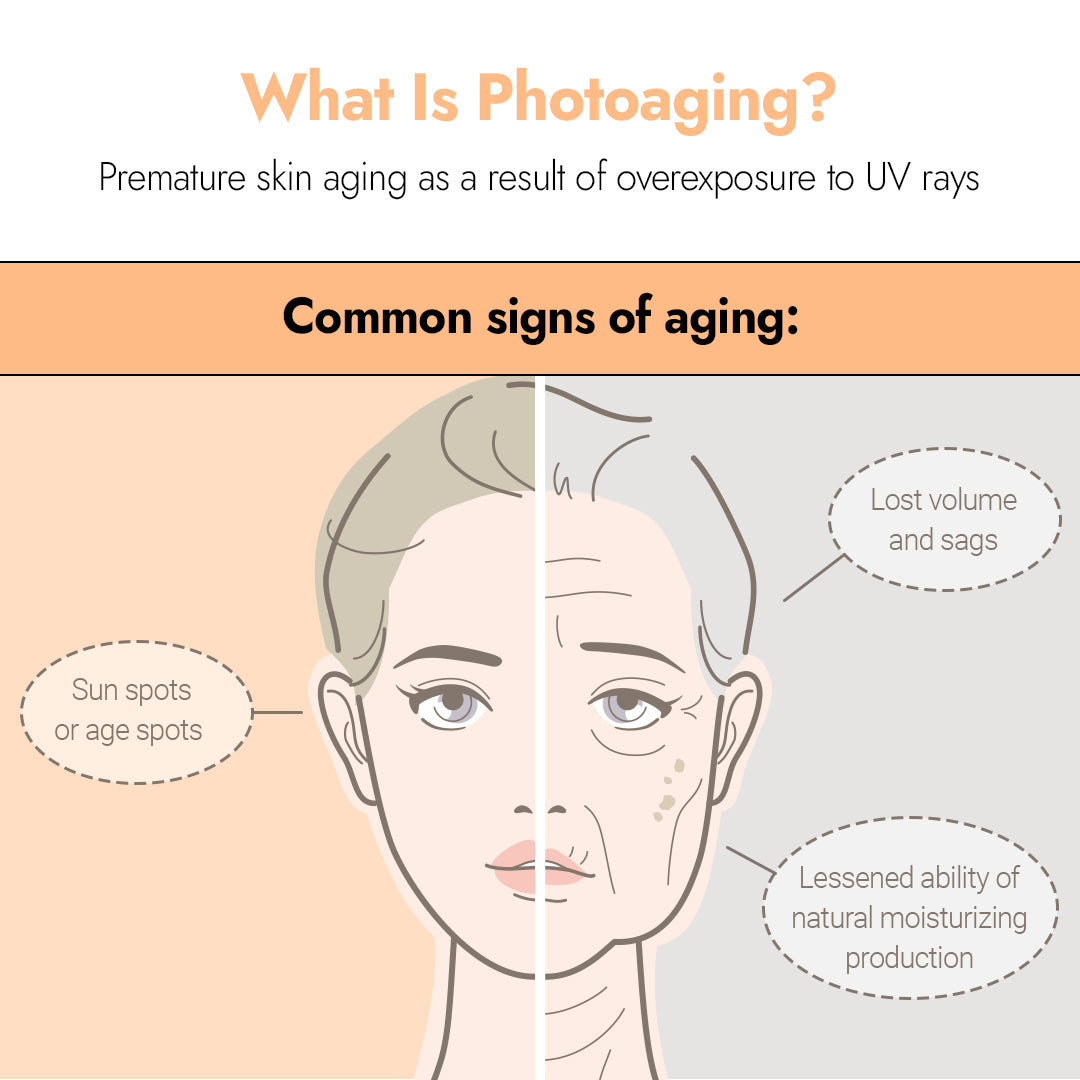 What Is Photoaging