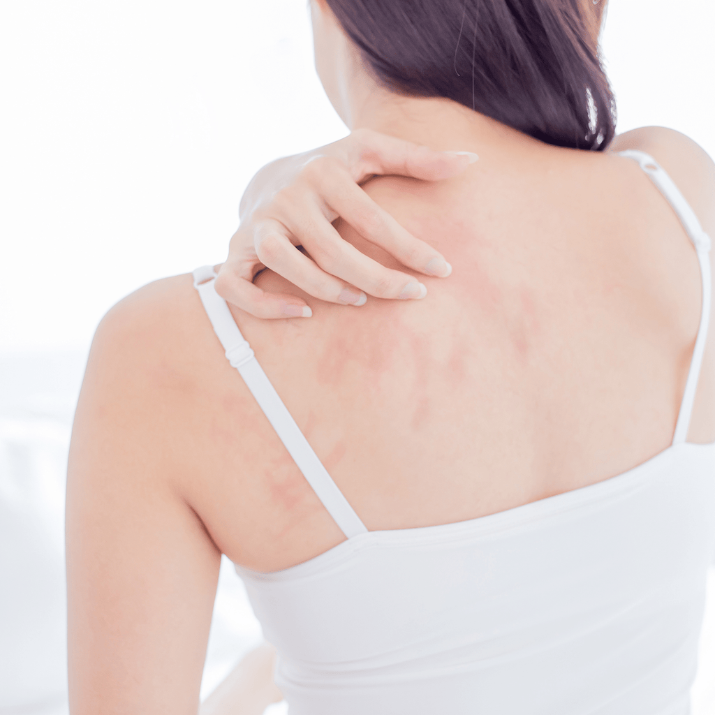 10 Treatments For Dry Itchy Skin In Winter Dry Skin Love Skincare