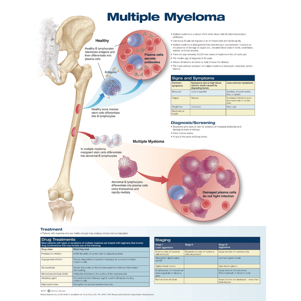 Multiple Myeloma — Medshop Australia