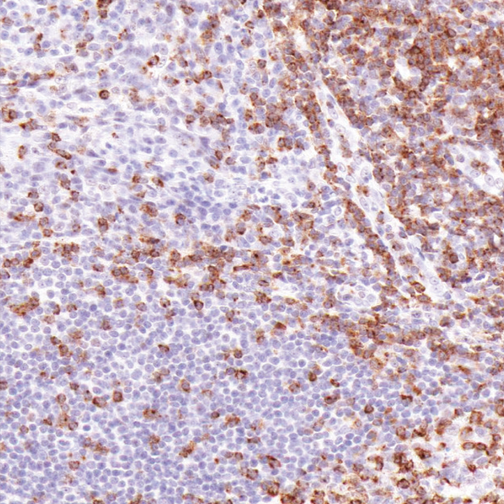 Cd2 Antibody Clover Biosciences Llc