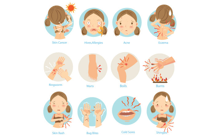 Itchy Skin At Night Causes Treatments And Prevention Vedix