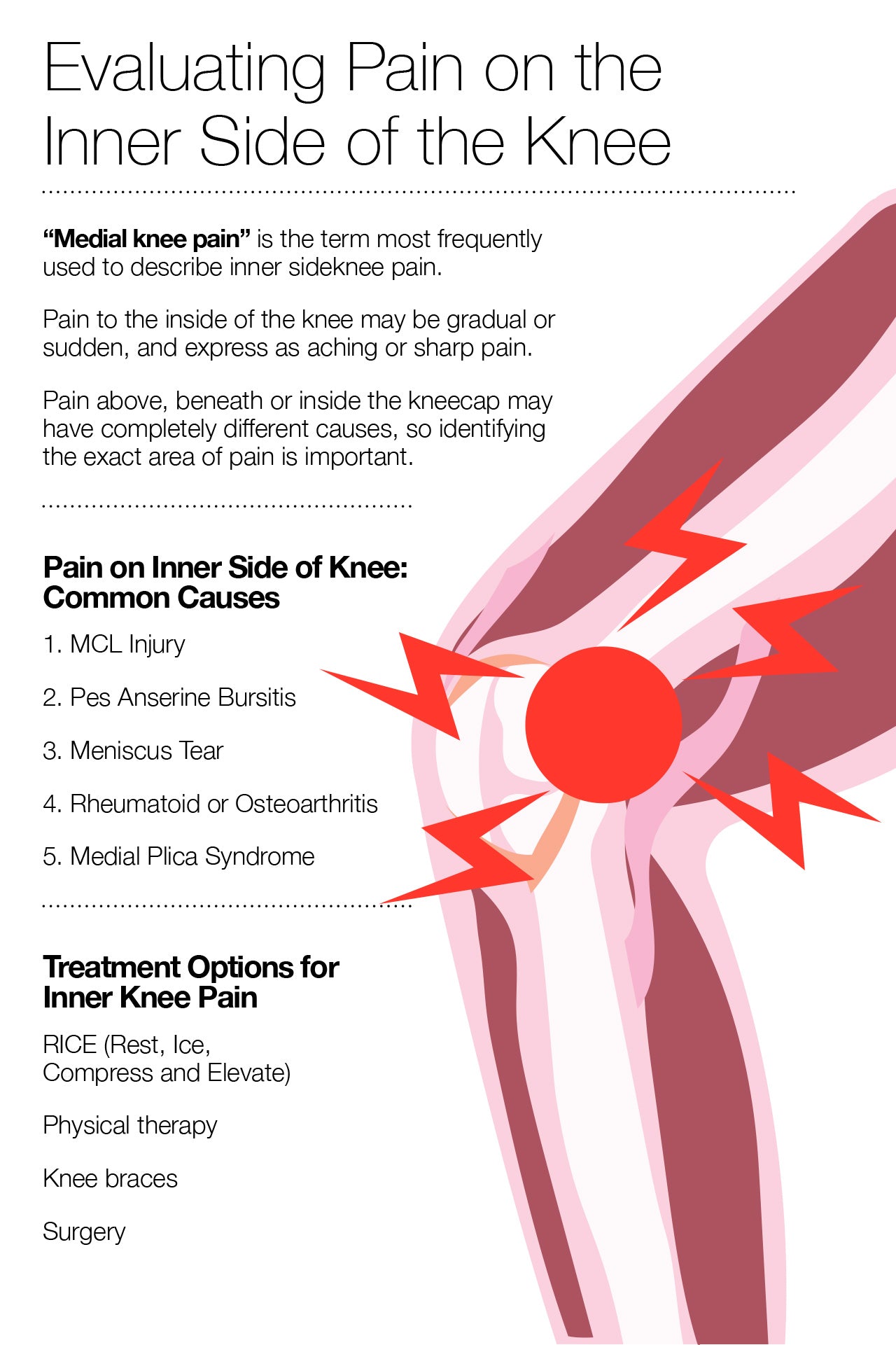 Knee Pain