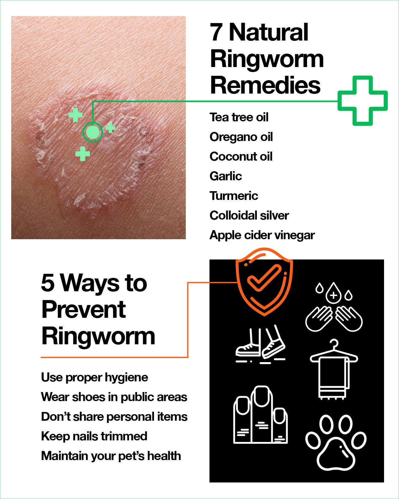 Getting To The Root Of Ringworm Causes And Prevention