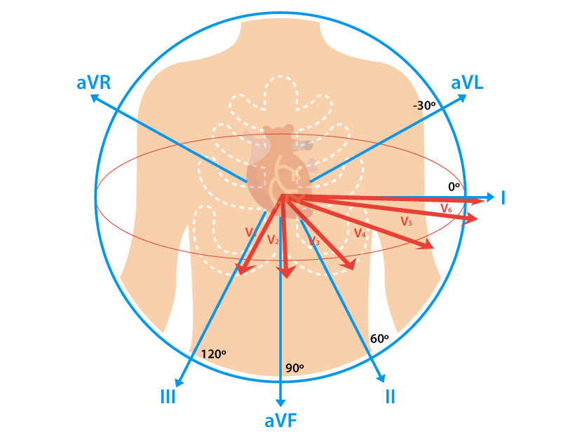 Ummd Ekg Basics