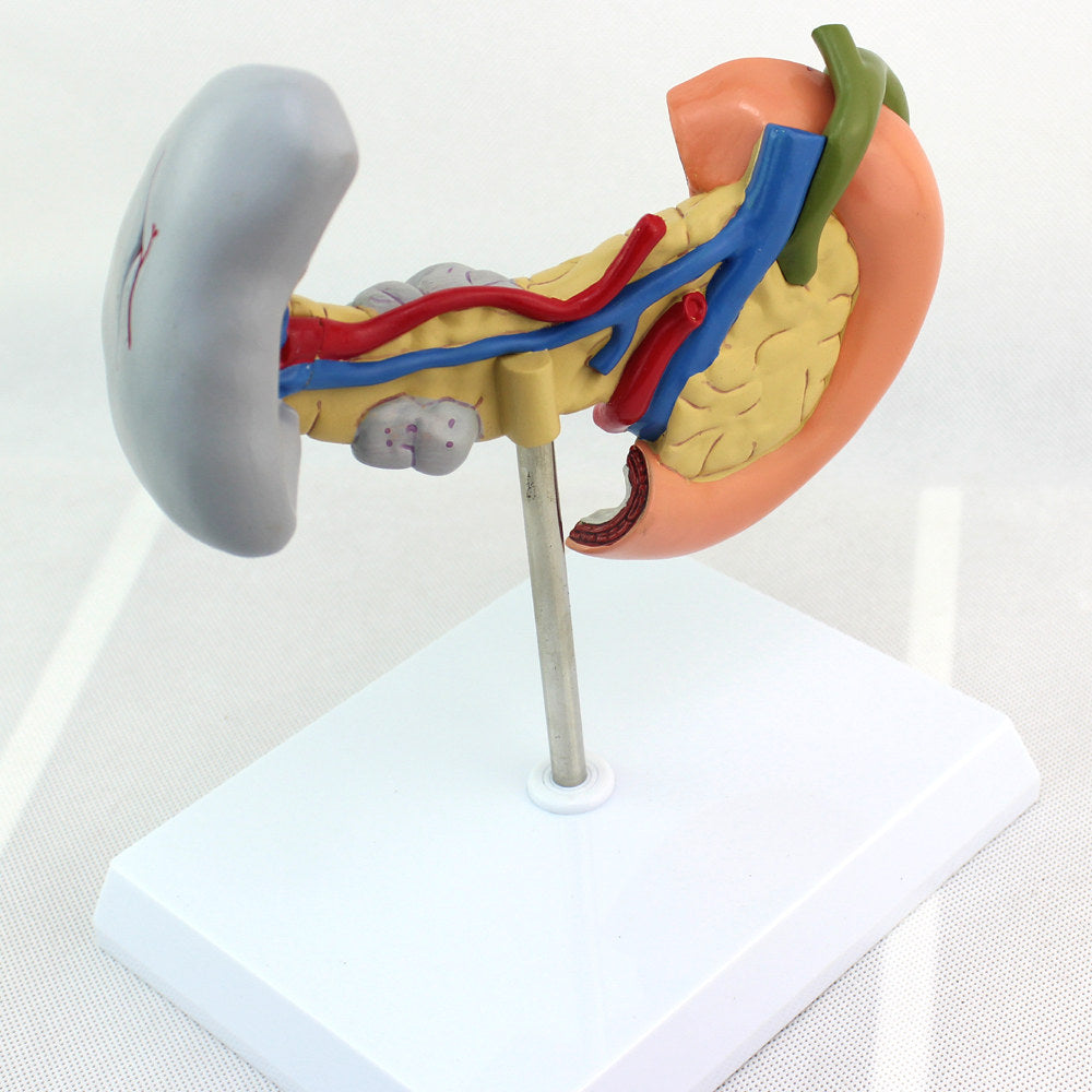 Pancreas Spleen Duodenum Model With Pathologies Djyxbl