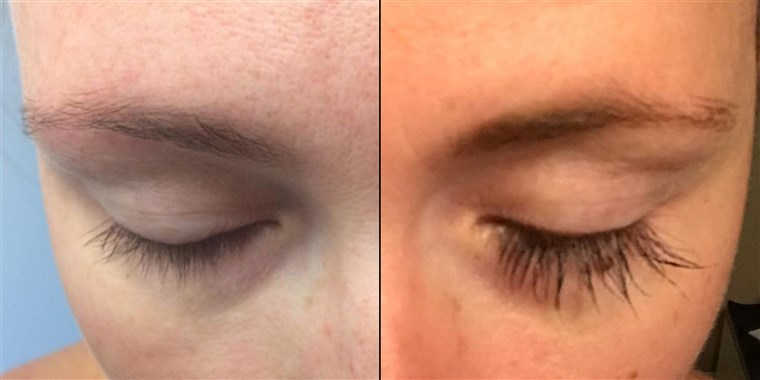 The Top Five Eyelash Serums Ranked Liaison Growth