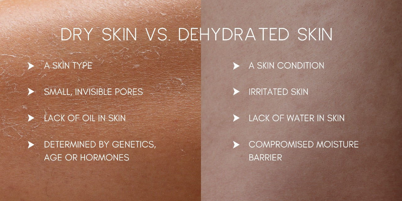 Dehydrated Skin Symptoms