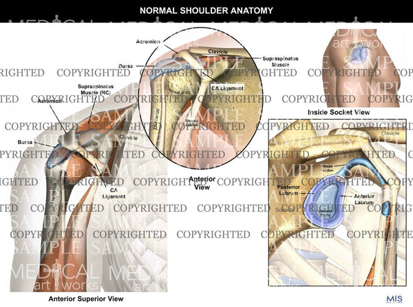 Normal Shoulder Anatomy With Socket View — Medical Art Works