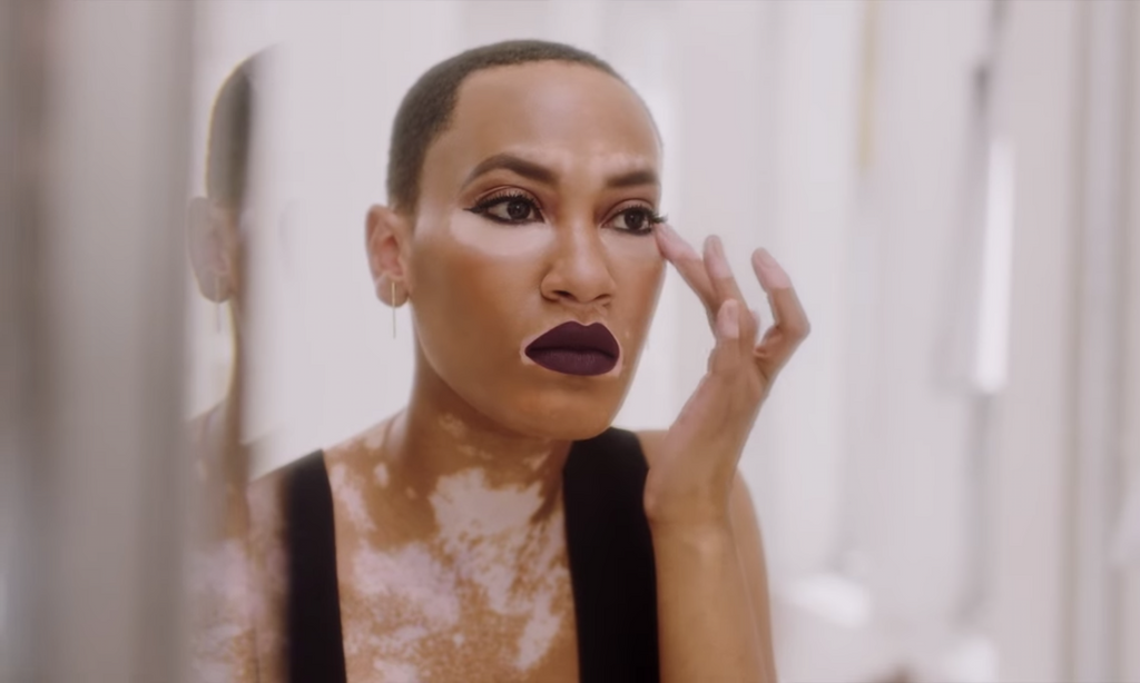 Covergirl Introduces Its First Ever Model With Vitiligo In New Foundat