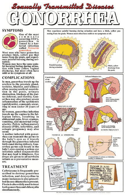 Gonorrhea Sexual Transmited Disease Poster Buyamag Buyamag Inc